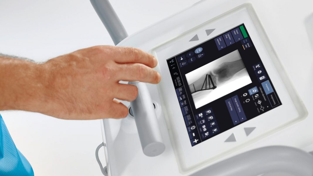 Arco cirúrgico: o que é, para que serve e como escolher? - HOSPITAIS BRASIL